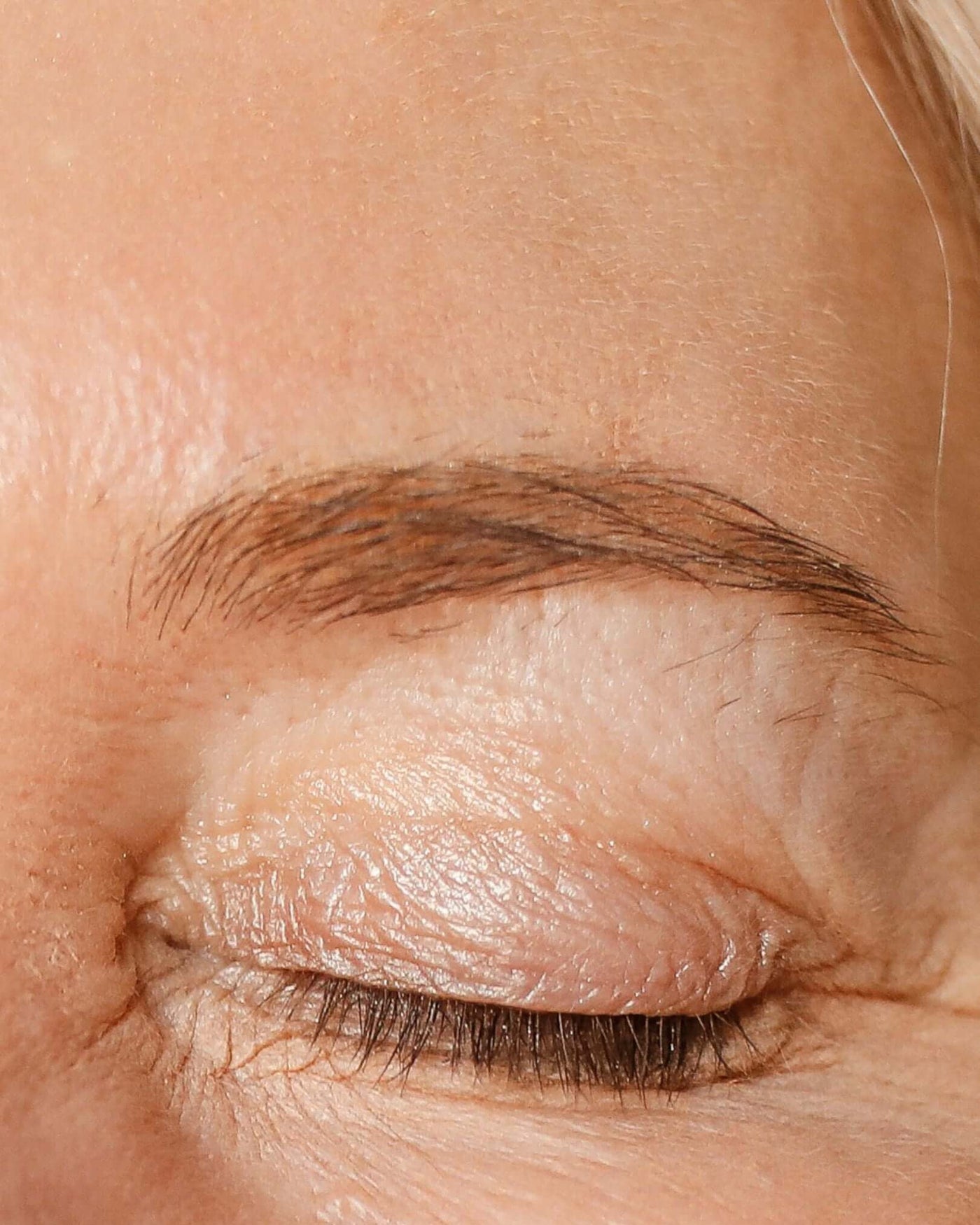 Face Age Calculator, Skin & Aging | AI Detection, FREE, No ADS