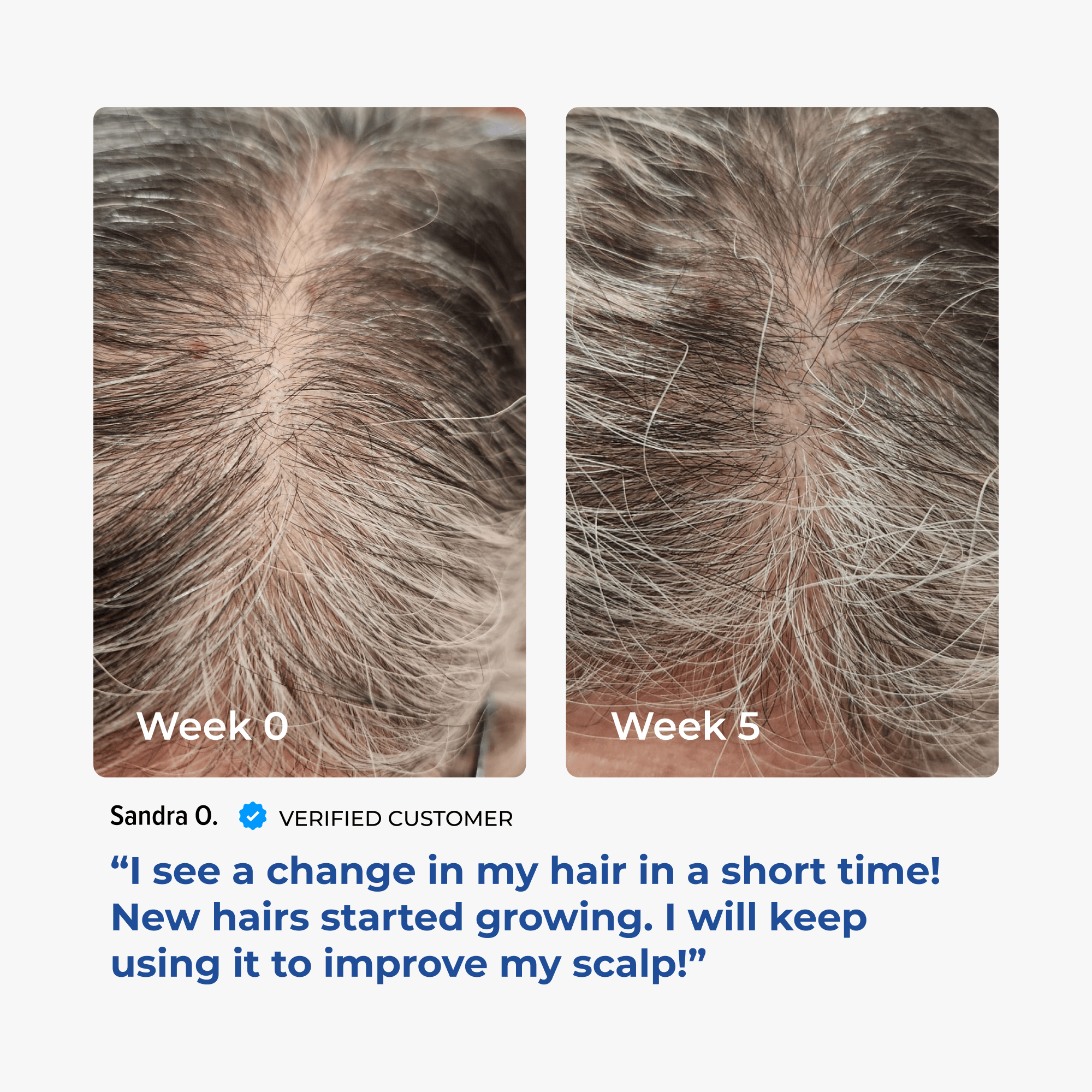 AHK-Cu + GHK-Cu Hair Serum Pro 4800mg | Hair Growth | Neurogan ...